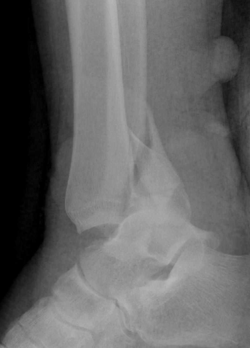 Background | The Bone School